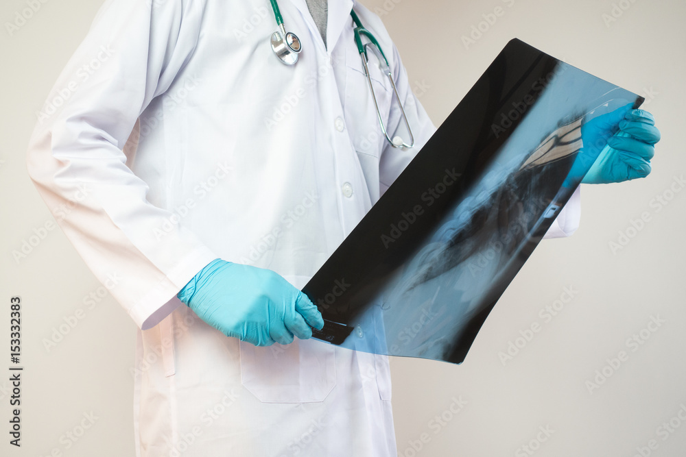 doctor checking chest x-ray film at ward hospital. Stock Photo | Adobe ...