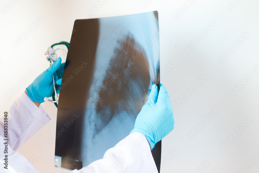 doctor checking chest x-ray film at ward hospital. Stock Photo | Adobe ...