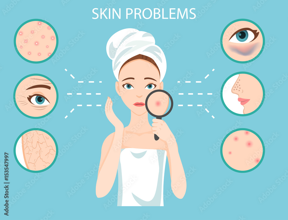 Troubled woman and set of most common female facial skin problems needs ...