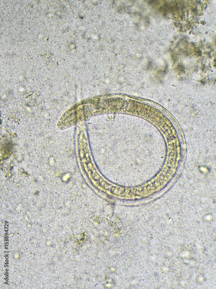 Strongyloides stercoralis (threadworm) in stool, analyze by microscope ...