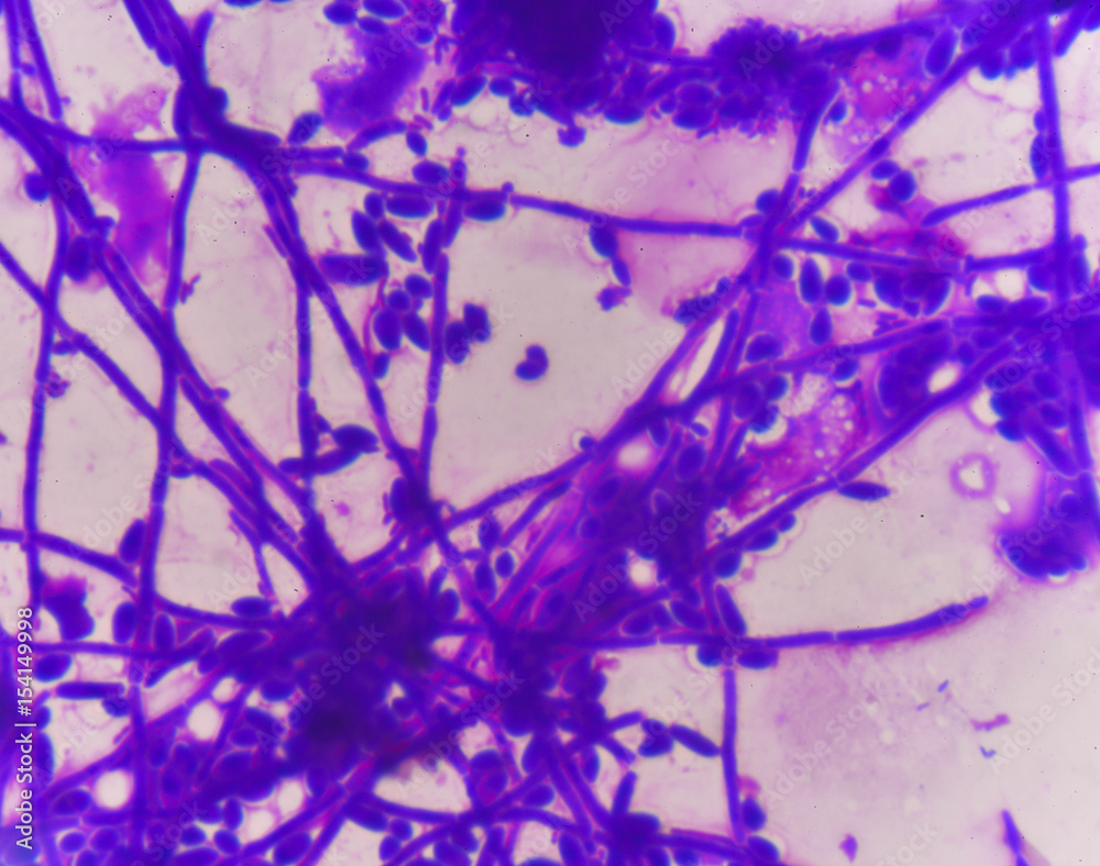 Budding yeast cells with pseudohyphae Gram stain method Stock Photo ...