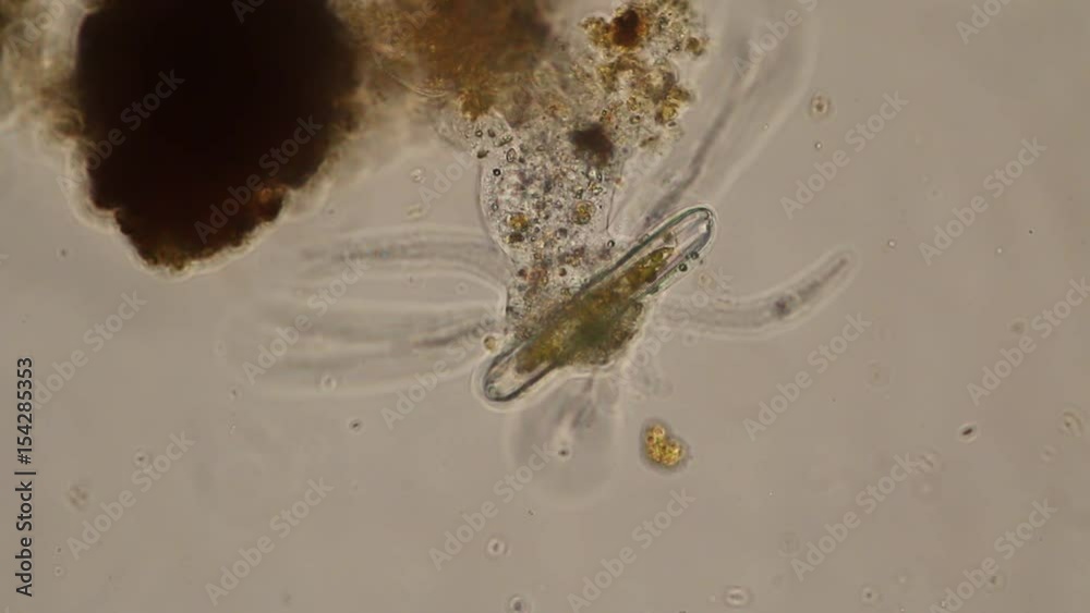 Amoebae move and feed by using pseudopods, which are bulges of ...