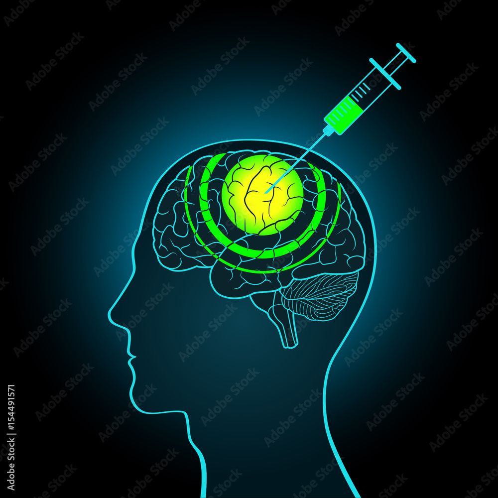 The injection syringe into the brain of truth serum, brainwashing ...