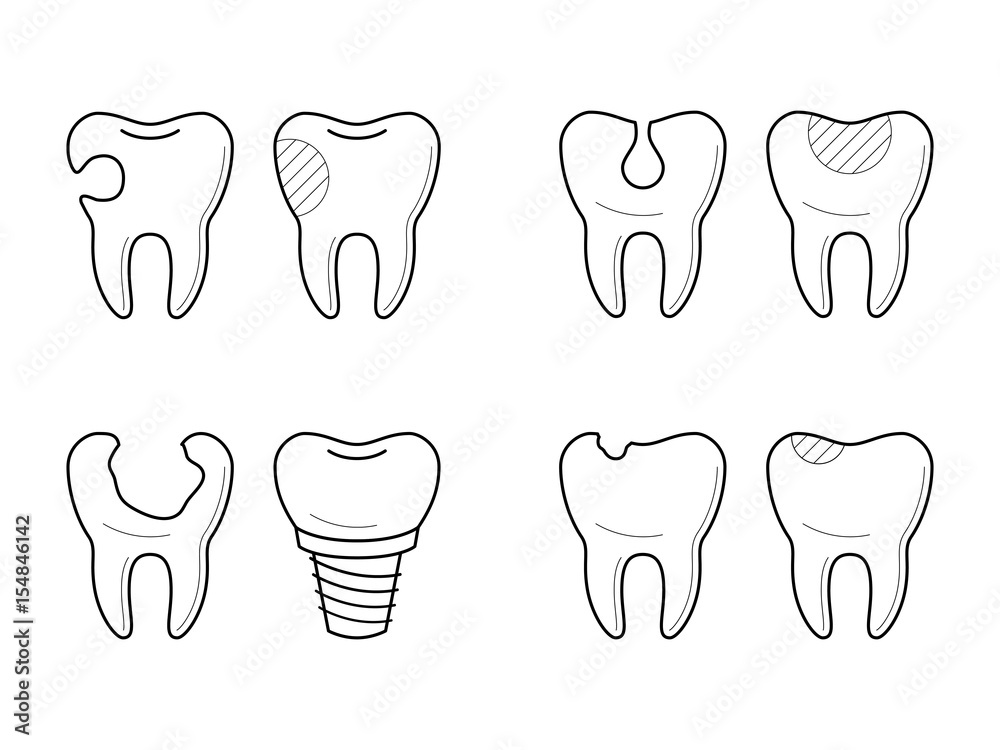 Icons of tooth before and after treatment, reconstruction or prosthetic ...