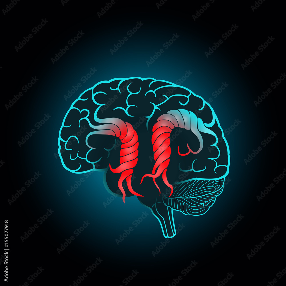 Brain with the twisted convolutions, of the destruction of the brain ...