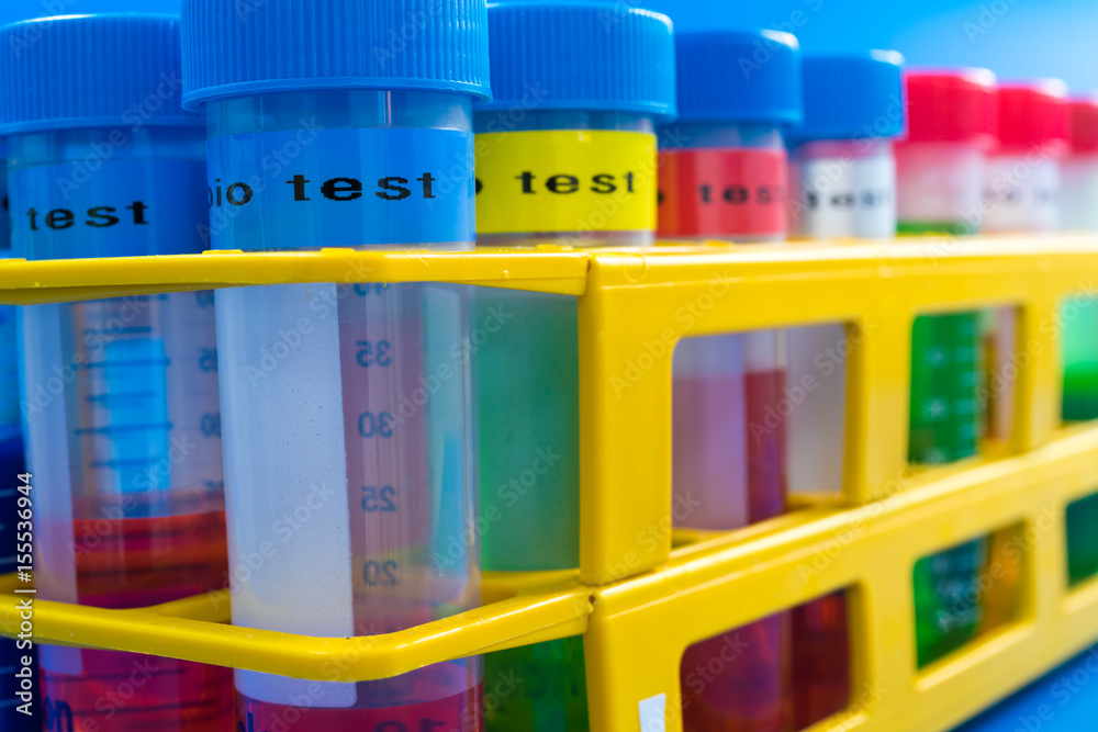 centrifuge test tubes with bio samples for microbial testing Stock ...