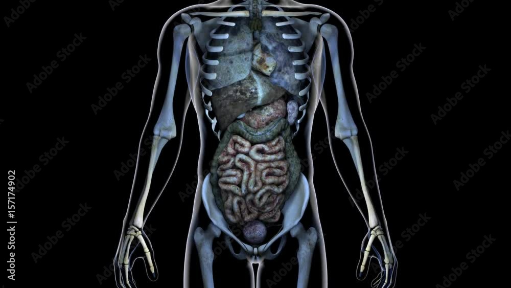 Internal Organs Get Sick in a Transparent Human Body Anatomical 3D ...