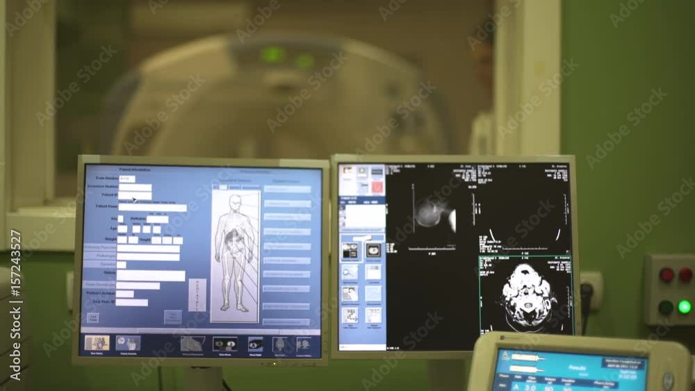 Crane motion, tilt up from monitor screen with x-ray images of human ...