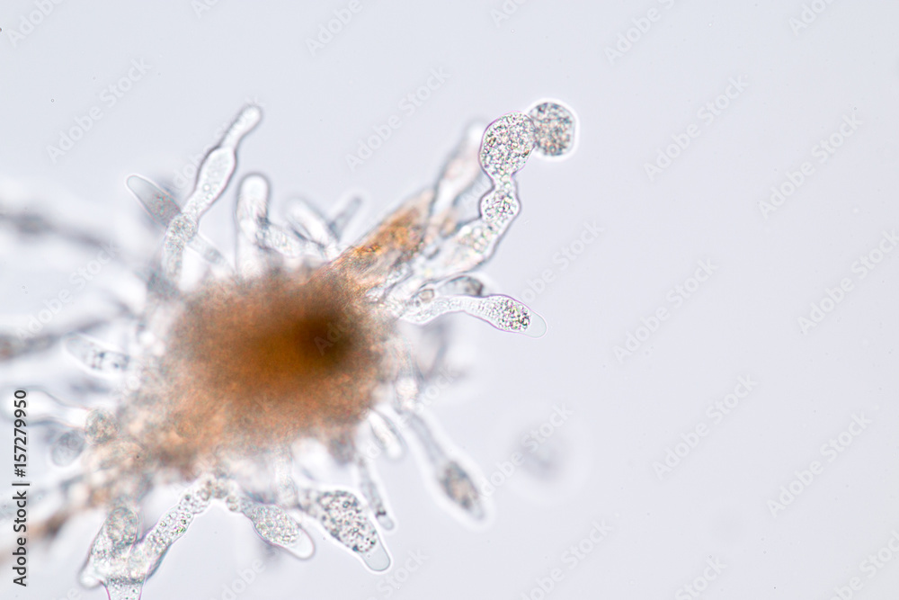 Amoebae move and feed by using pseudopods, which are bulges of ...