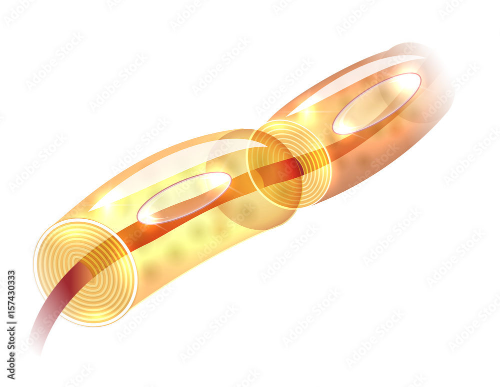 Neuron, nerve cell axon and myelin sheath substance that surrounds the ...