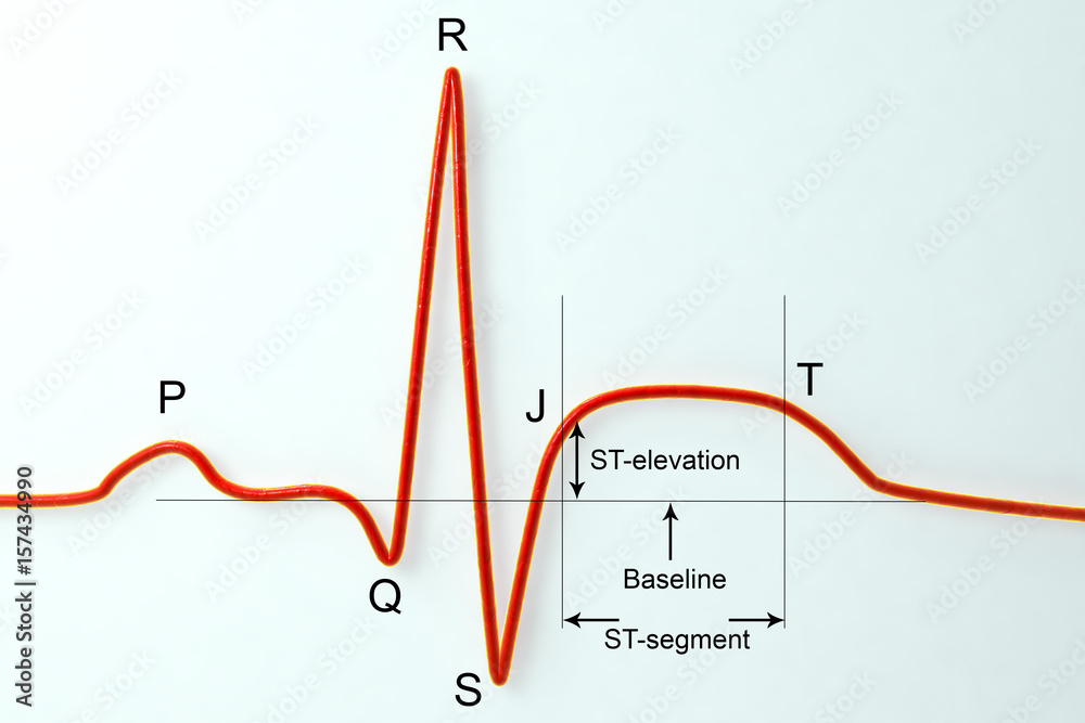 Diagram Of St Elevation