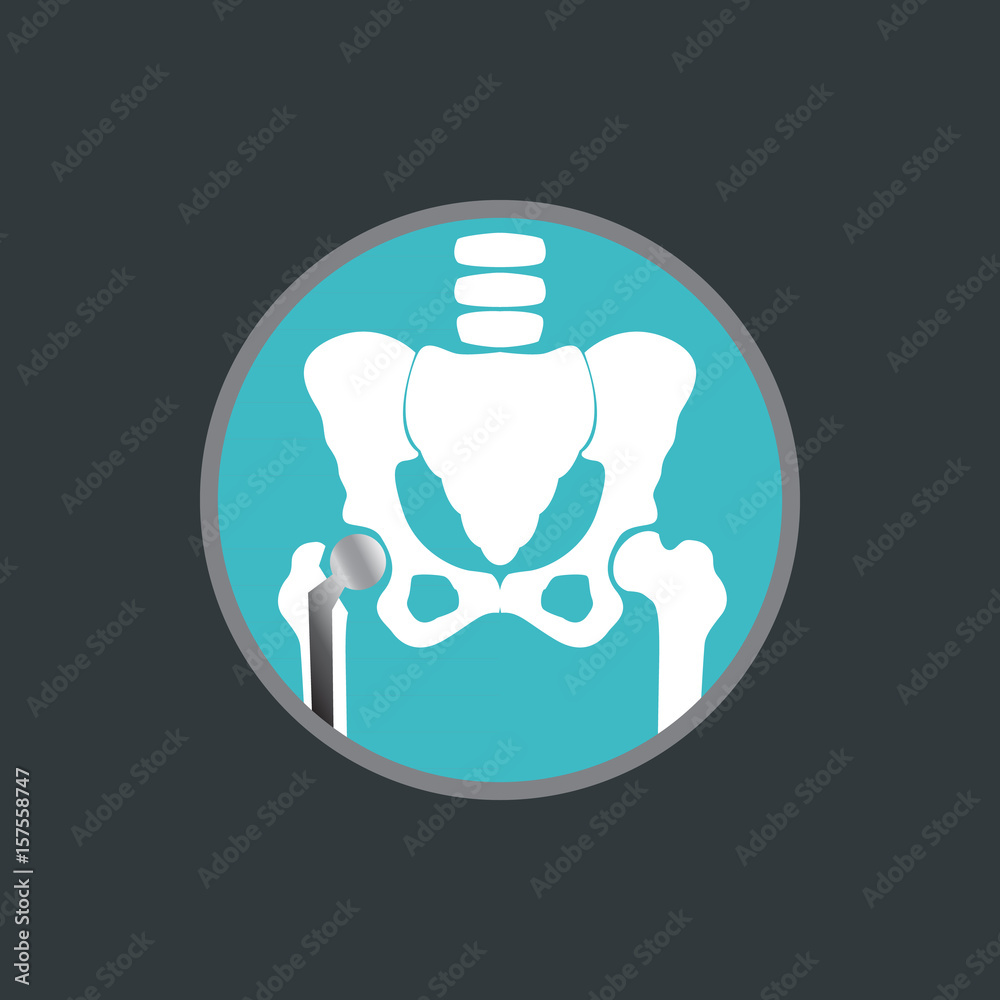 Hip replacement logo vector icon design Stock Vector | Adobe Stock
