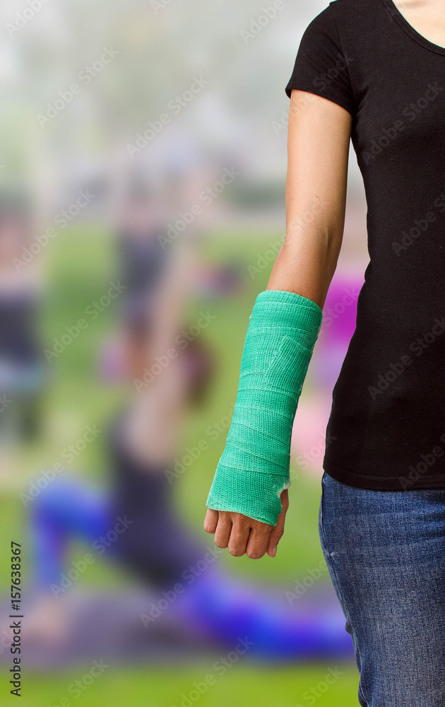 Green Arm Cast