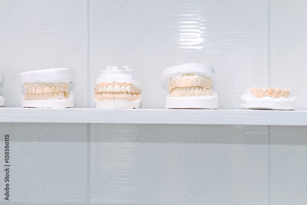 Few model jaws with wire braces stacked, example of dental and ...