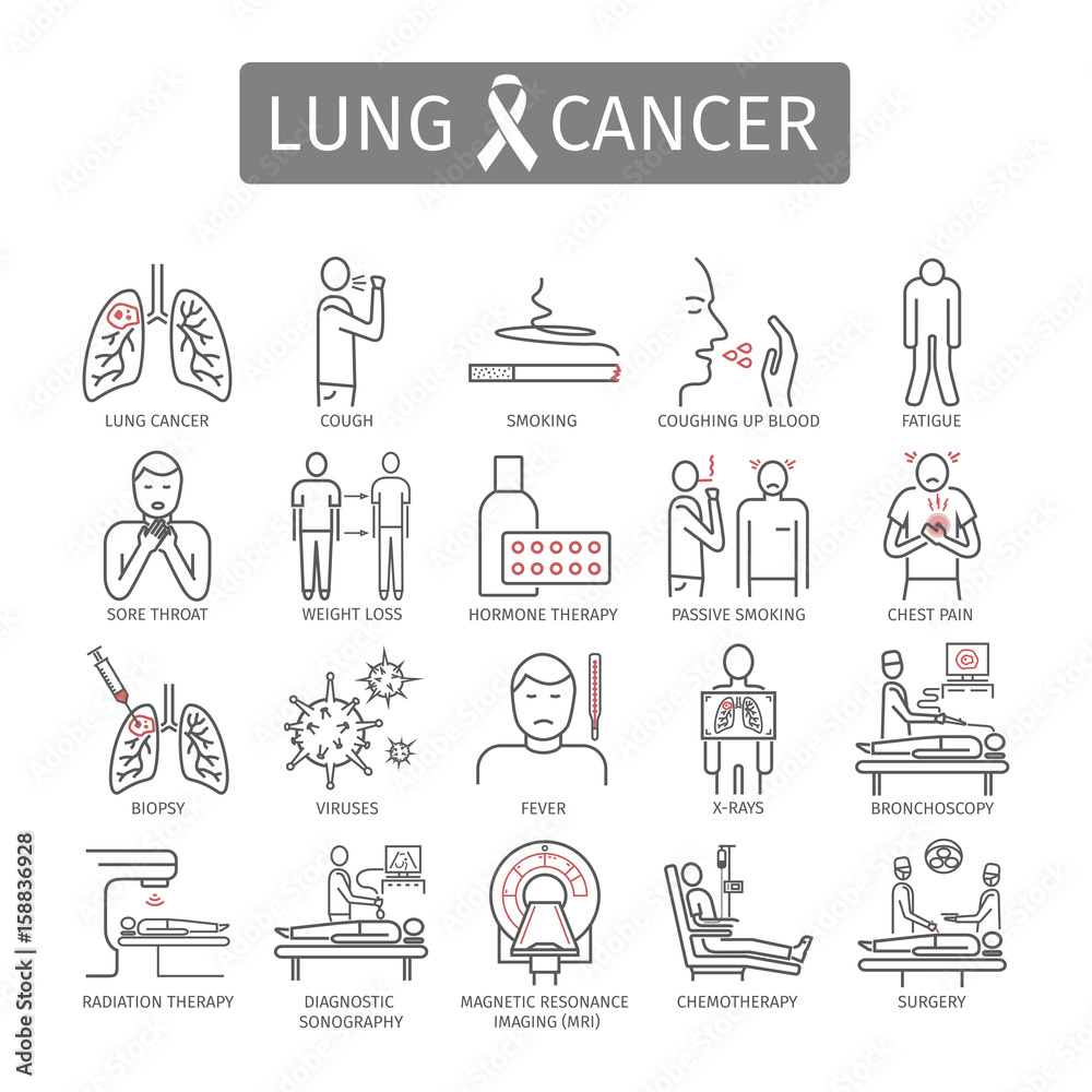 Lung Cancer Signs And Symptoms And Treatment - Infoupdate.org