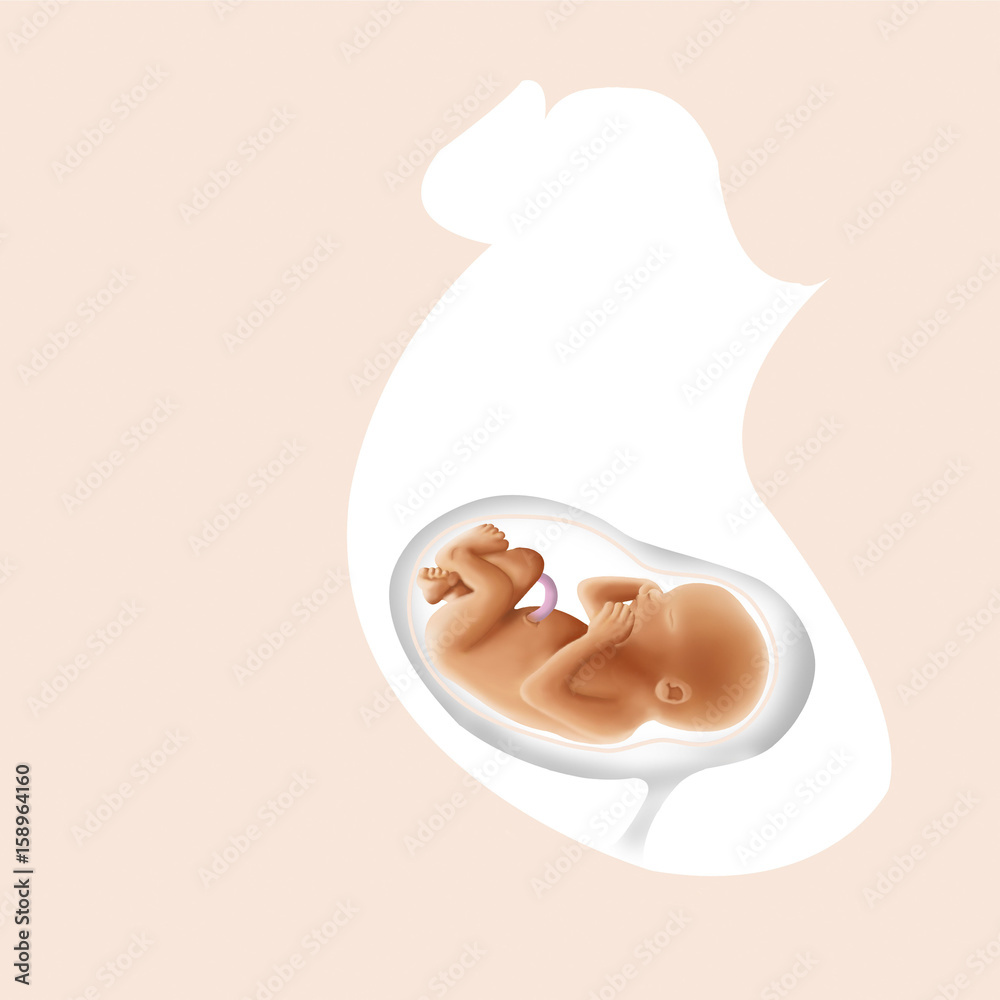 Transverse Presentation