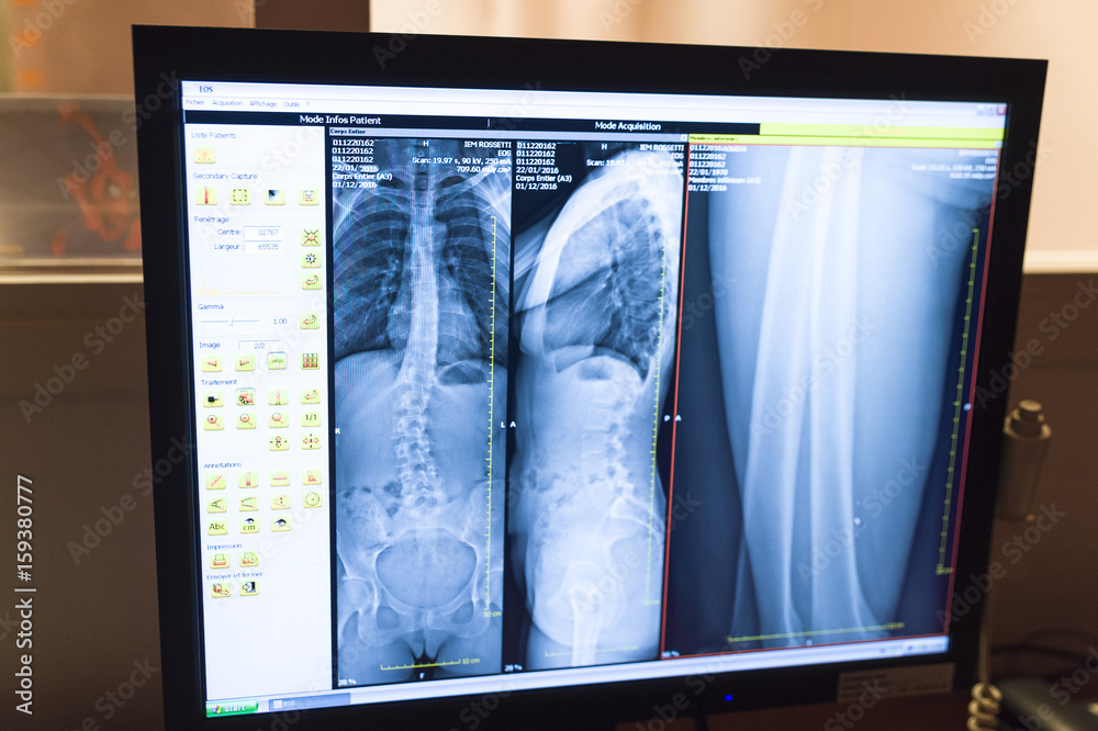 EOS X-RAY IMAGING Stock Photo | Adobe Stock