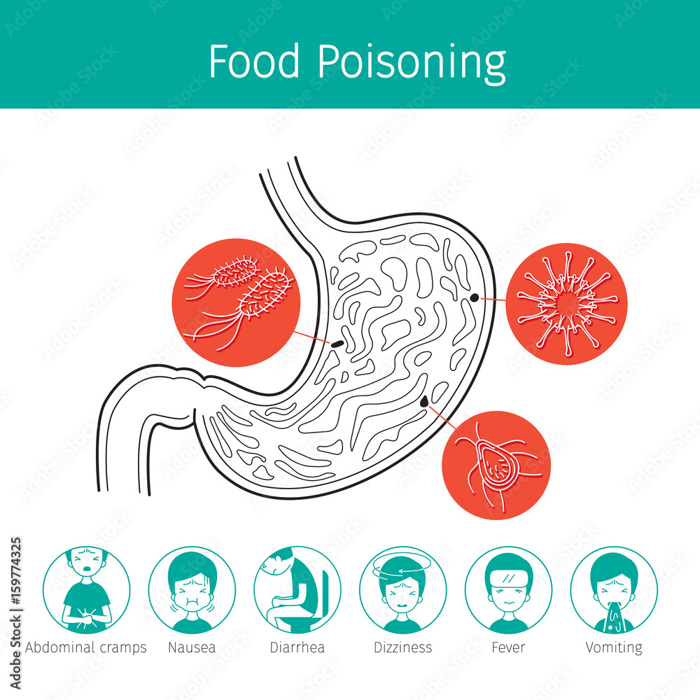 Stockvector Germs In Stomach Cause To Stomachache And Food Poisoning ...