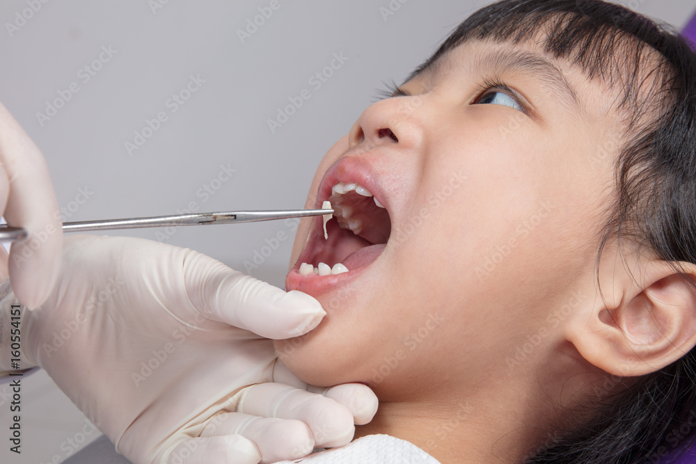 Asian Chinese little girl lying down for tooth extraction Stock Photo ...