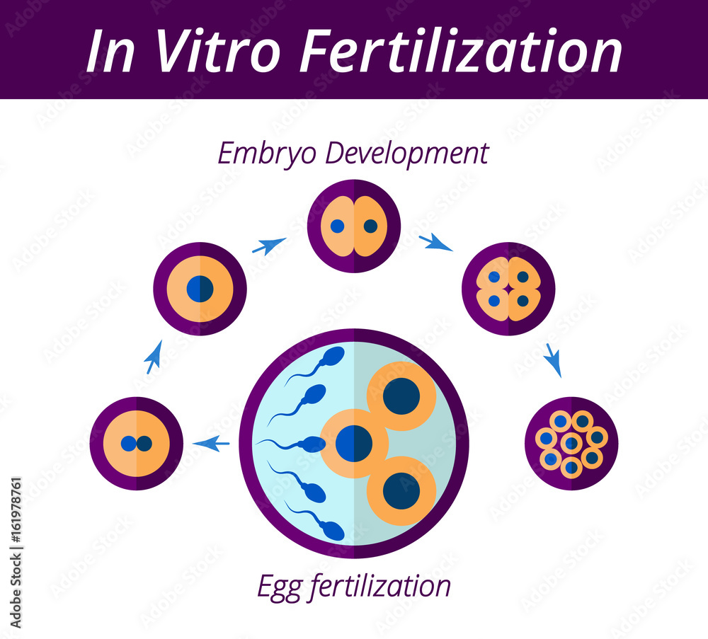 Scheme of artificial insemination. In vitro fertilization chart in flat ...