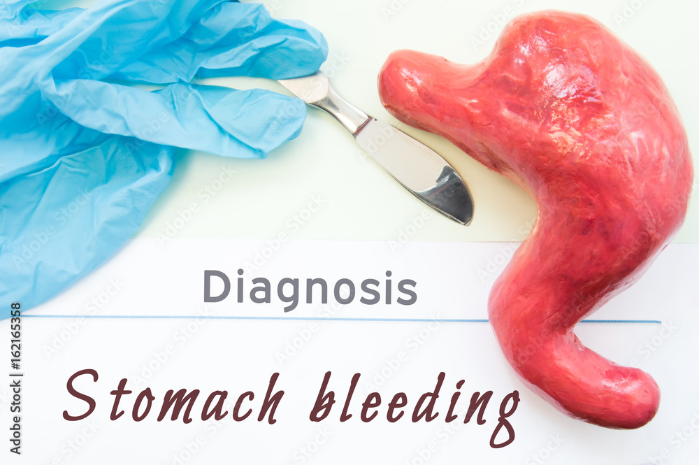 Diagnosis of Stomach Bleeding. Figure stomach, scalpel and surgical ...
