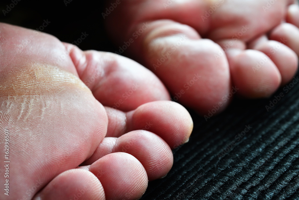 the underside of the foot Stock Photo | Adobe Stock