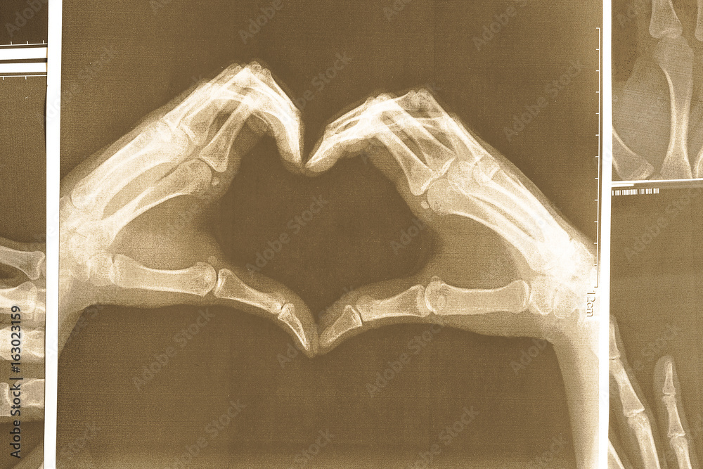 X-ray image of hands making heart symbols. Stock Photo | Adobe Stock