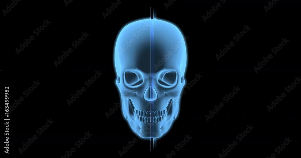 Skull scan concept / 3D animation of digital medical scanner plane ...
