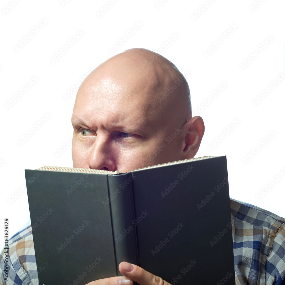 Autoimmune total alopecia men portrait. Absolute bald head without ...