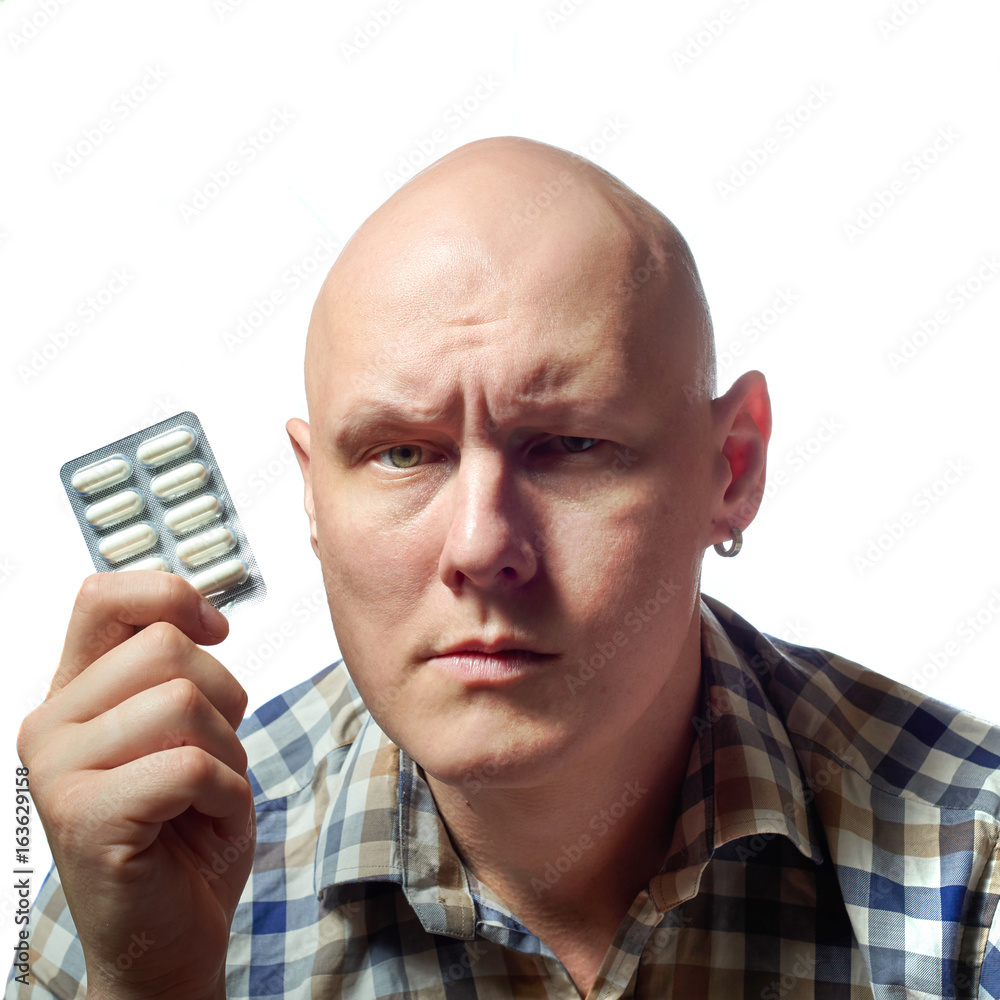 Autoimmune total alopecia men portrait. Absolute bald head without ...