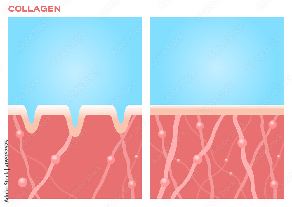 collagen in younger skin and aging vector version Stock Vector | Adobe ...