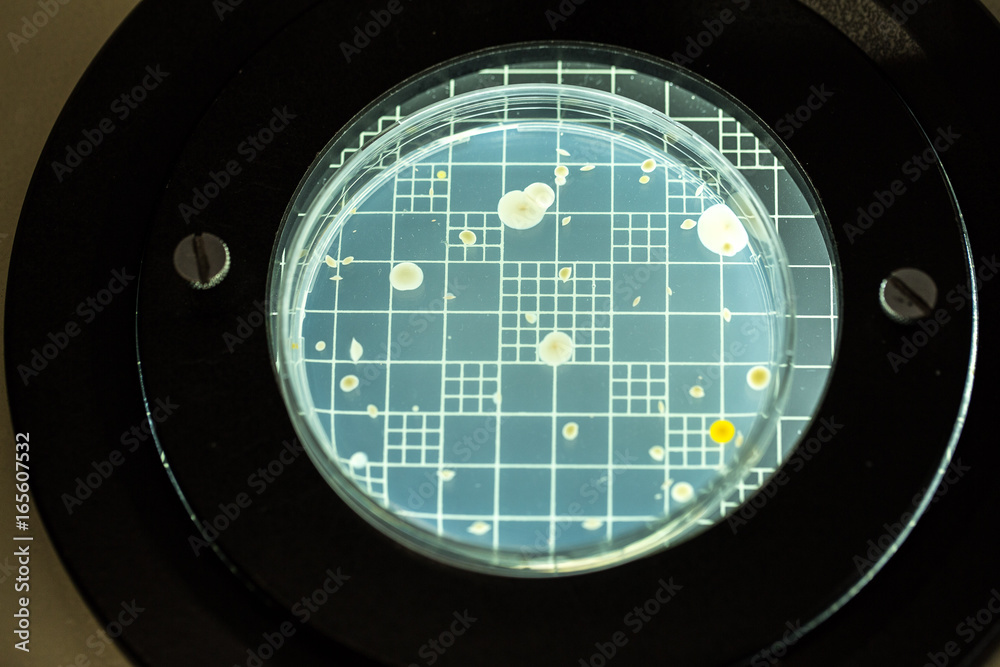 Colony counter with petri plate with agar bacterial culture Stock Photo ...