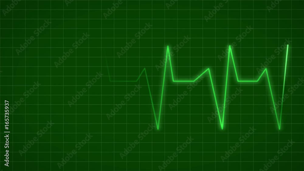 ECG Electrocardiogram Display Heart Rate Beat Pulse Looped animated ...