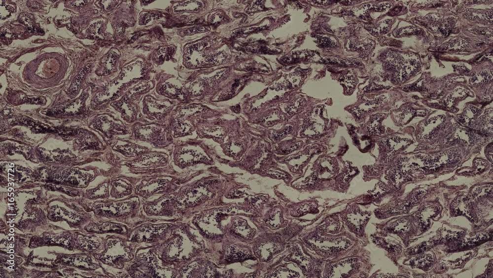 human scrotum cells under a microscope zoom in animation Stock ビデオ ...