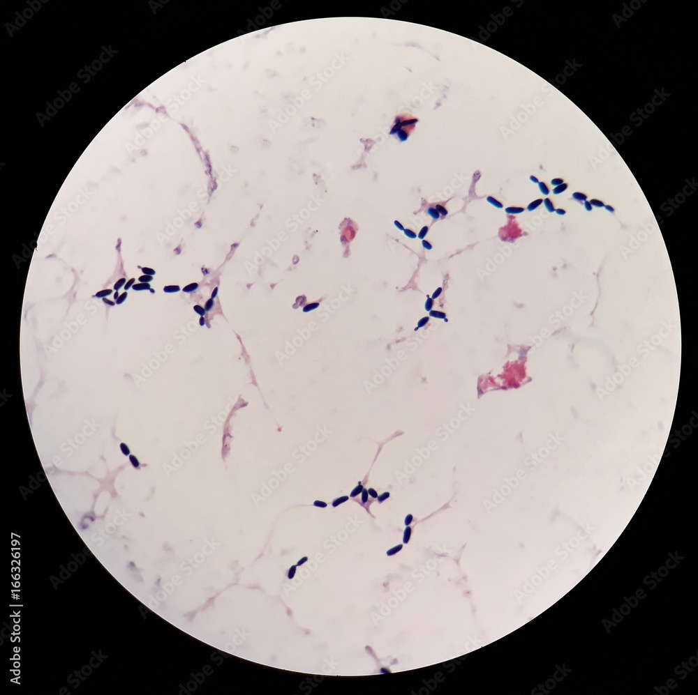 Budding Yeast Gram Stain