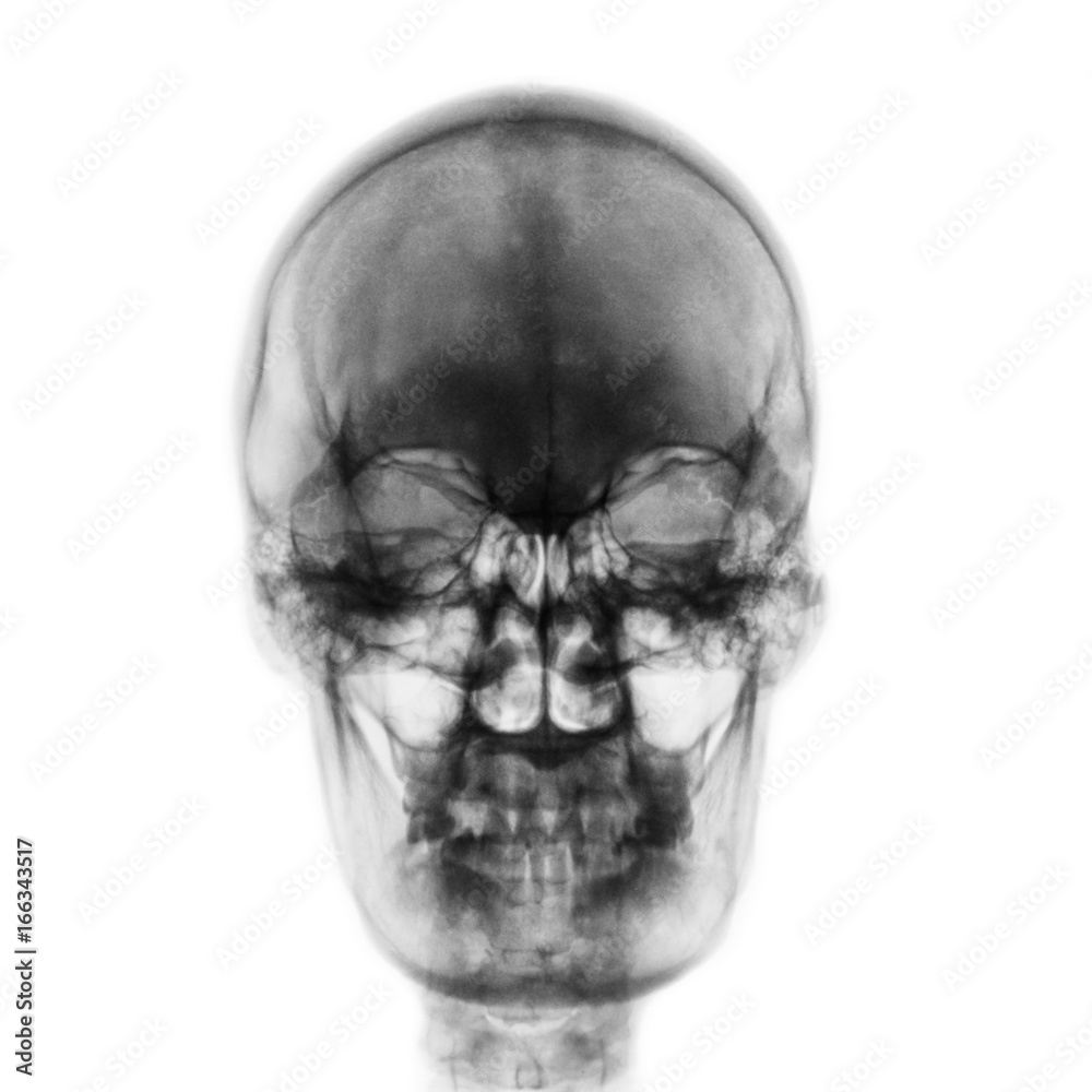 Human Skull 34 View