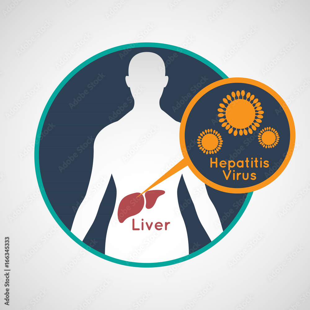 Vector illustration of Hepatitis Stock Vector | Adobe Stock