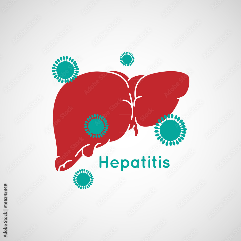 Vector illustration of Hepatitis Stock Vector | Adobe Stock