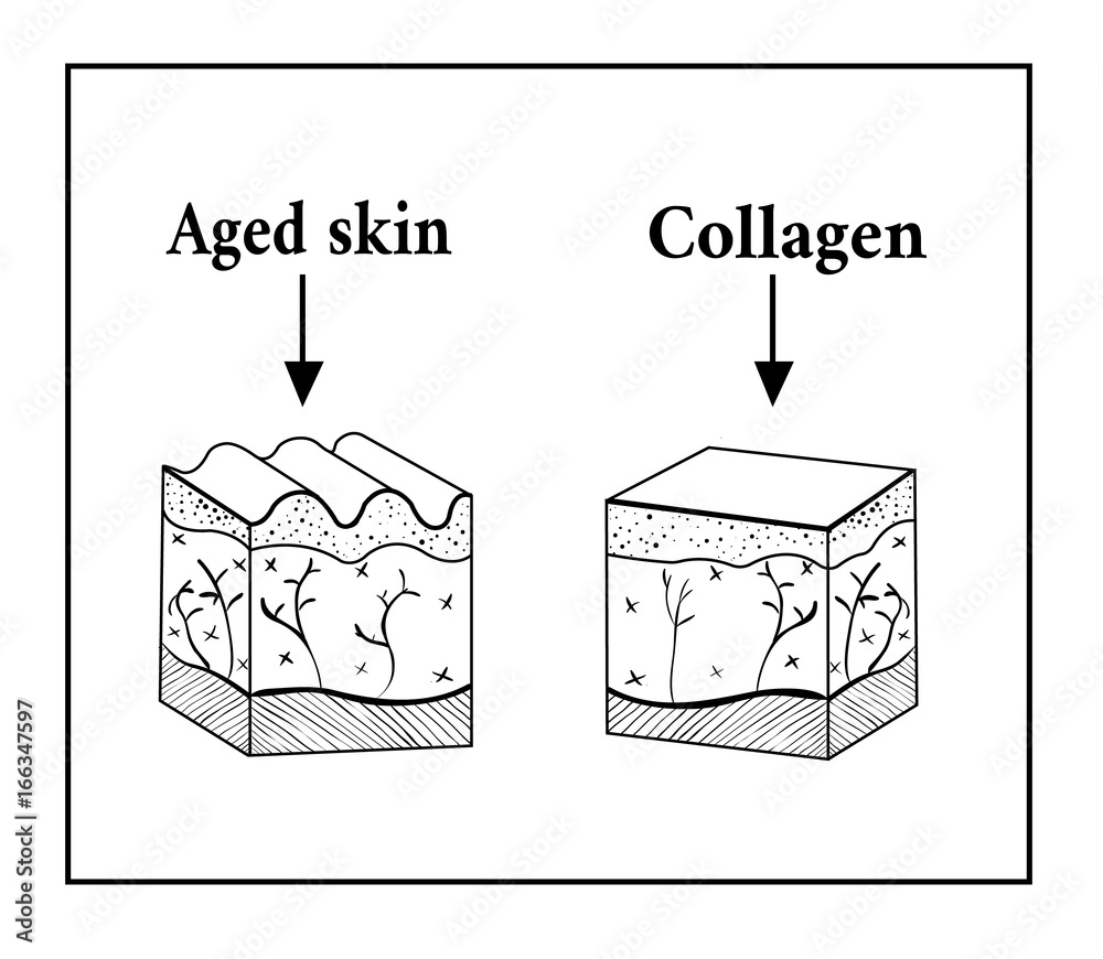 Schema of the skin under the influence of collagen. Old and collagen ...