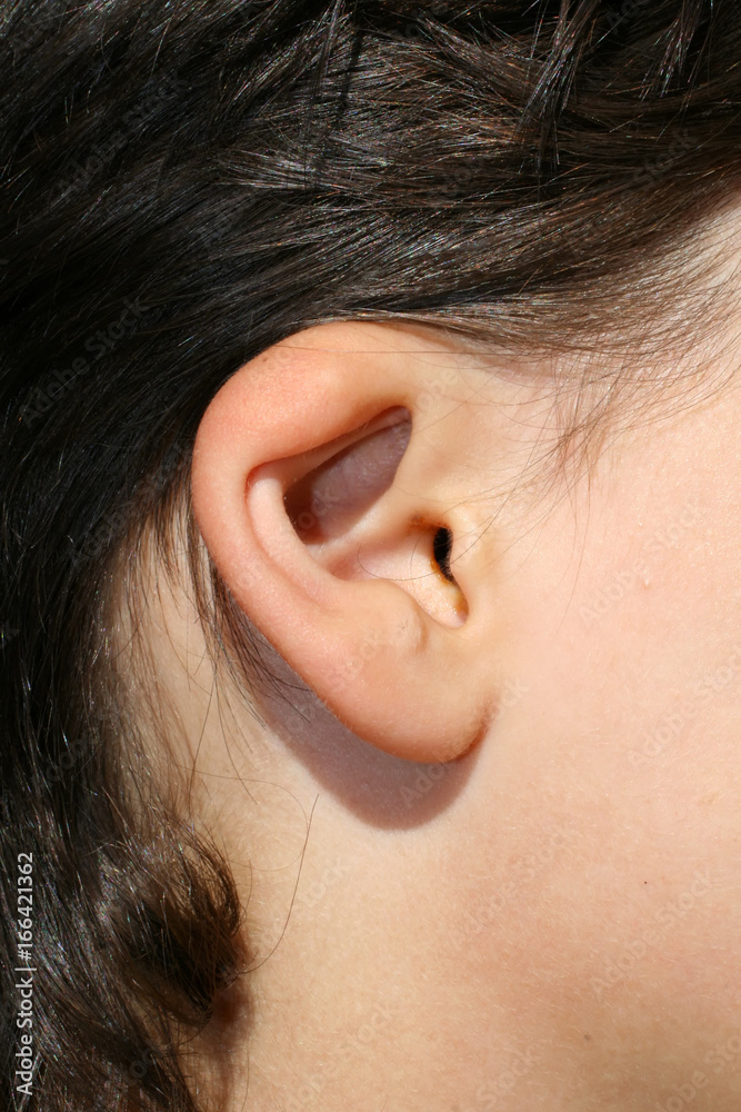 Deformed ear. Abnormal development of the auricle. Plastic surgery and ...
