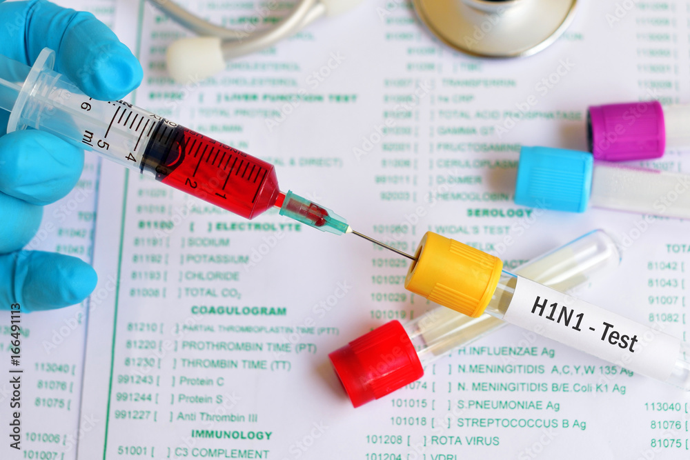 H1n1 Tests