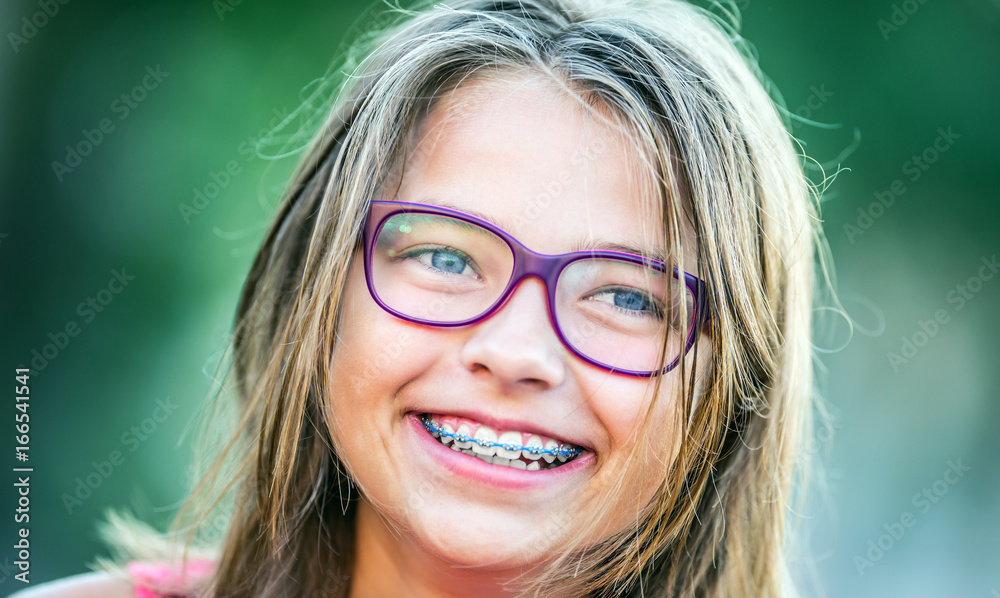 Happy smiling girl with dental braces and glasses. Young cute caucasian ...