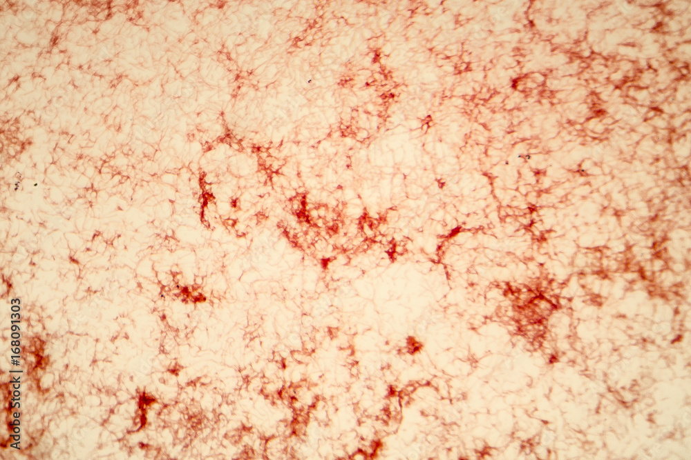 Actinomycetes, gram-positive anaerobic bacteria which resemble fungi ...