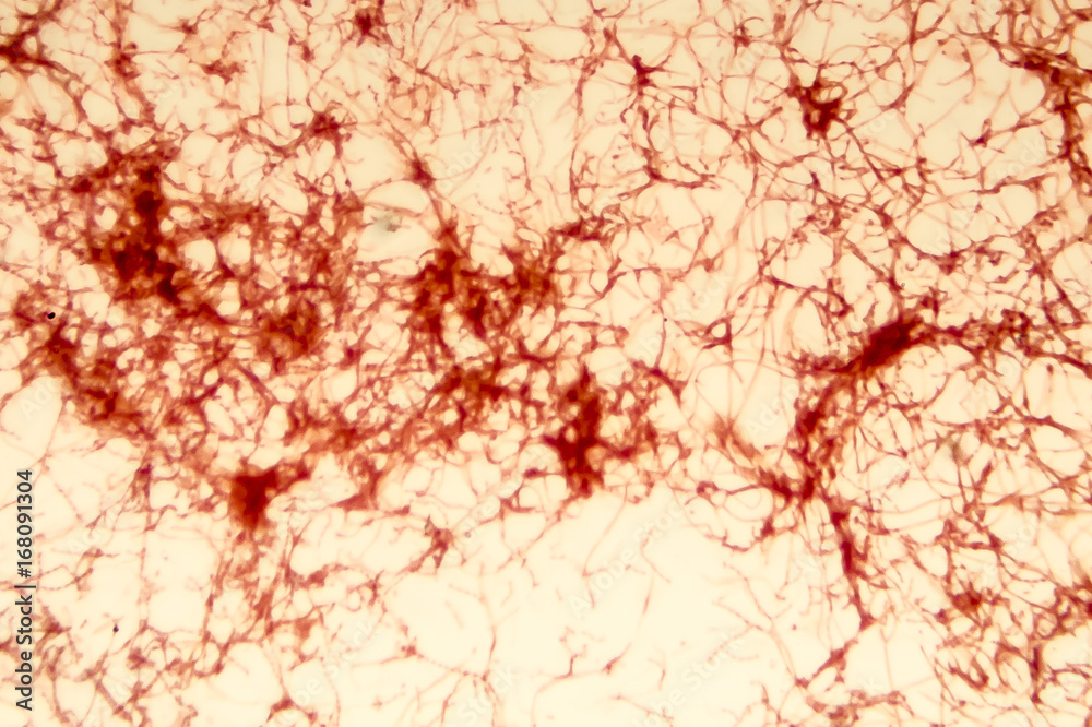 Actinomycetes Gram Positive Anaerobic Bacteria Which Resemble Fungi Light Micrograph