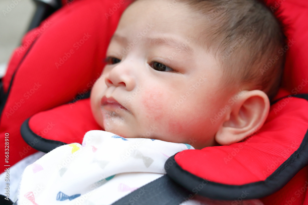 cute baby boy playful bubbles saliva drool on child mouth with allergic ...