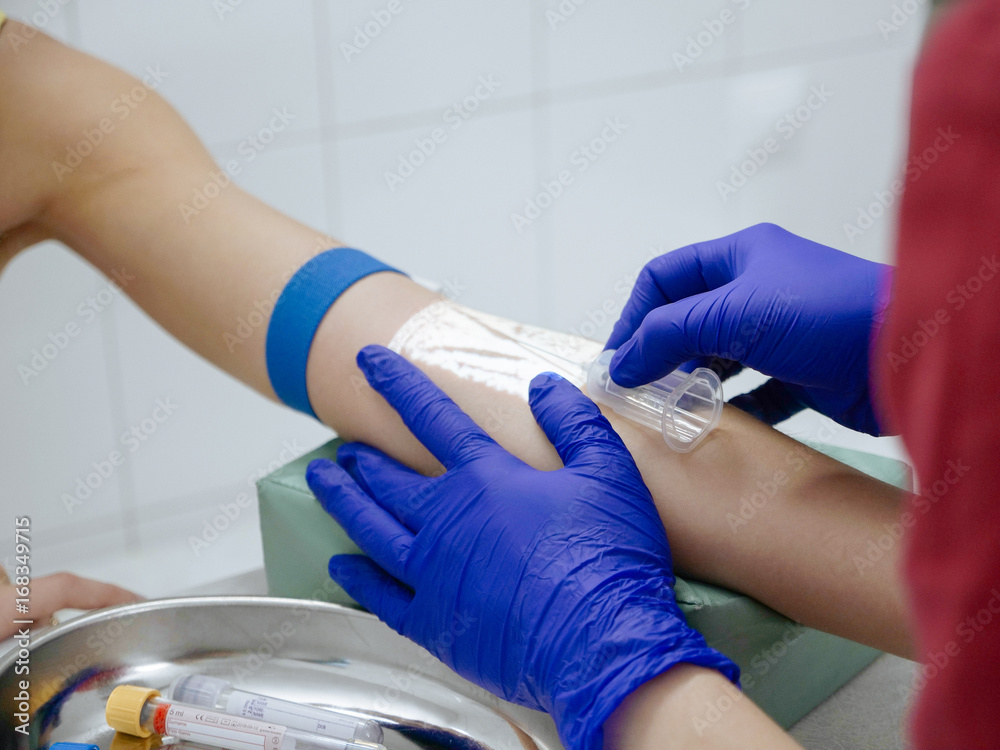 Nurse taking blood for analysis via veins projector device Stock Photo ...