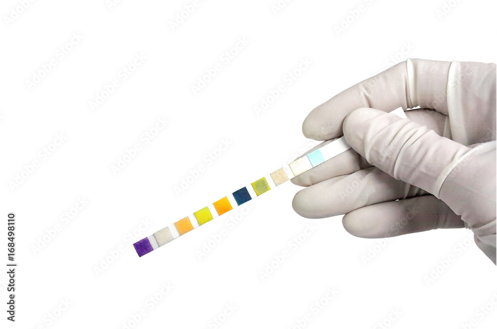 Hand in white glove holding urine strip positive leukocyte esterase for ...