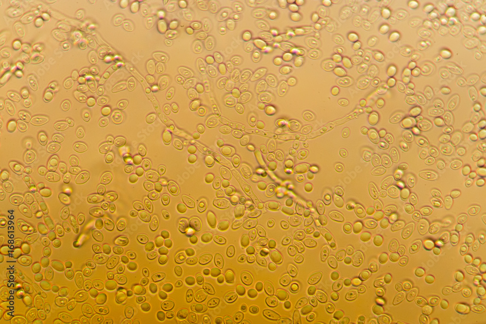 Yeast under the microscope. Stock Photo | Adobe Stock