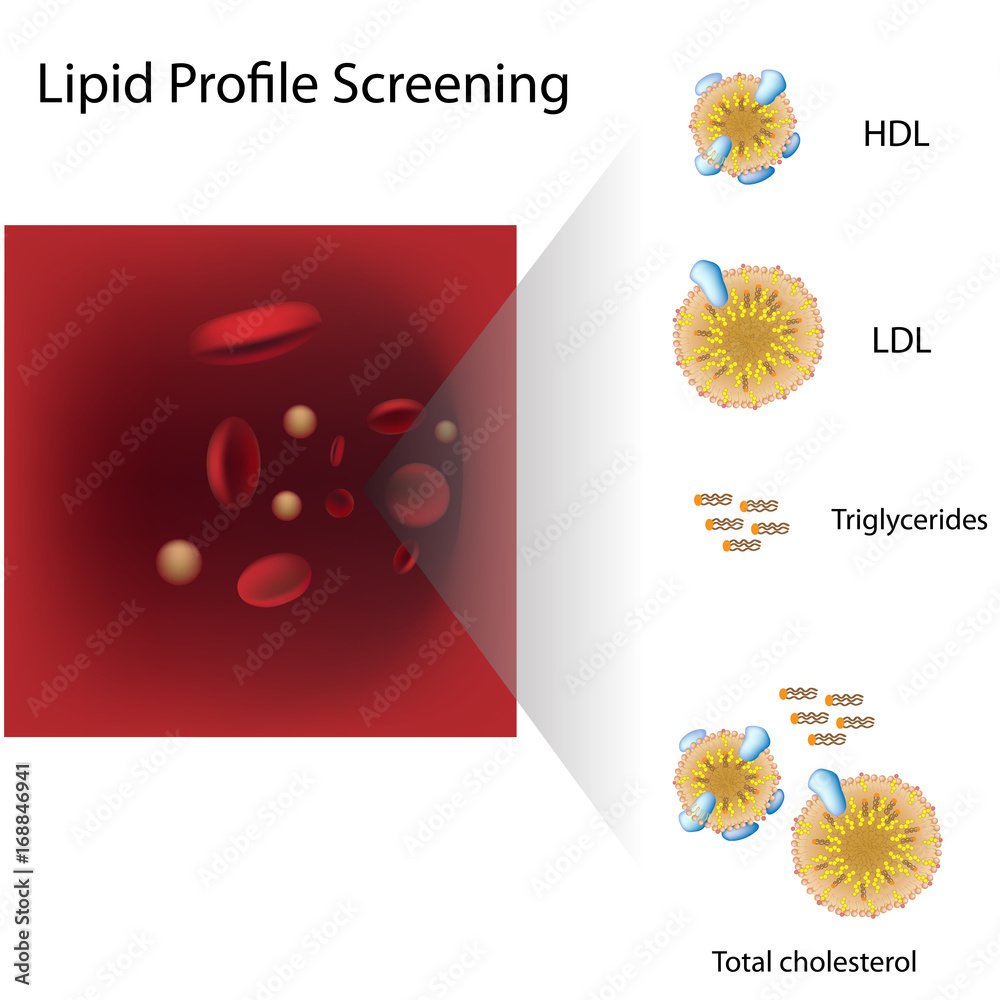 Lipid profile blood test Stock Illustration | Adobe Stock
