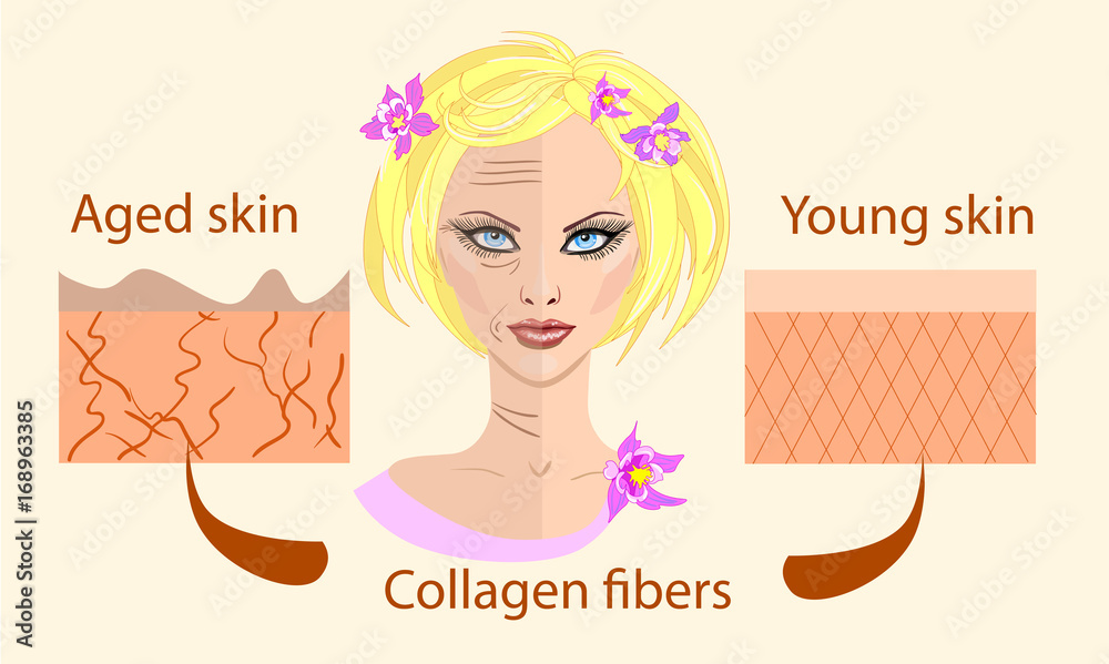 skin aging diagrams. young skin is firm tight, its collagen Vector ...